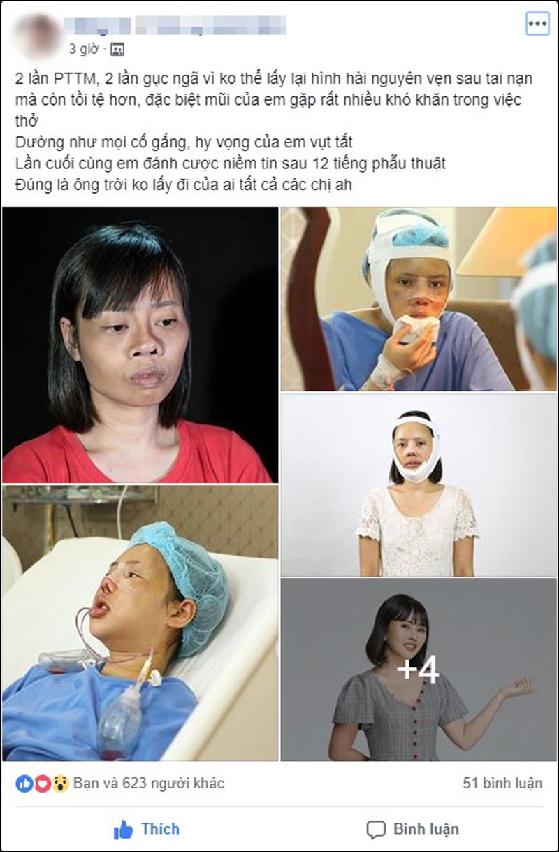Bị Tai Nạn Biến Dạng Khuôn Mặt Cô Gái Kiên Trì Pttm 3 Lần Và Cái Kết Bất Ngờ