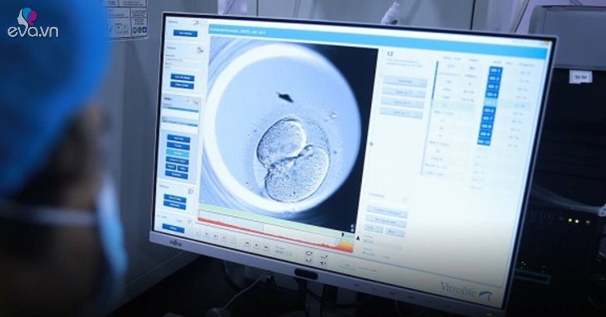 Sinh con ra phát hiện đứa trẻ không giống mình và sự nhầm lẫn tai hại ...