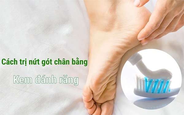 10 Cách trị nứt gót chân tại nhà tự nhiên an toàn hiệu quả nhanh nhất