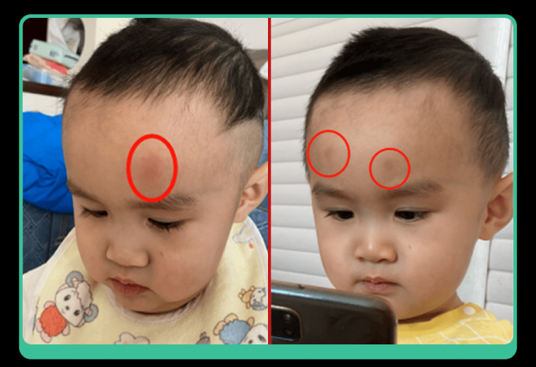 Con trai 4 tuổi thường xuyên đập đầu vào tường, mẹ sợ xanh mặt khi ...