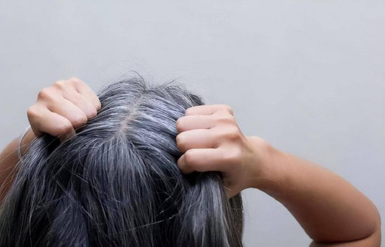 Còn trẻ mà đã thấy tóc bạc mọc ở 3 vị trí này, cẩn thận cơ quan nội ...