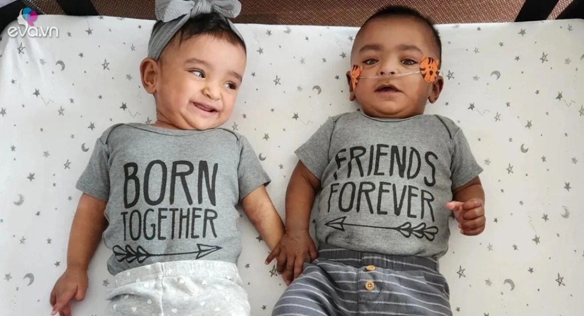 Cặp song sinh chào đời ở tuần 22 tưởng khó sống sót, không ngờ lại lập ...