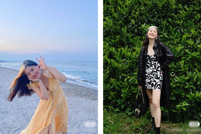 Bị nói quái vật vì mái tóc hiếm, gái xinh lấp liếm đến chảy máu, giờ ...