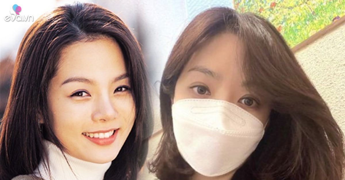 Nữ thần thanh xuân Chae Rim và hành trình lấy lại nhan sắc sau di chứng ...