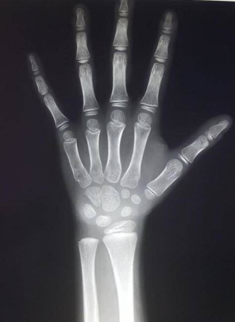 Bố cao 1m85 nhưng con lại thấp nhất lớp vì thường ăn những món này