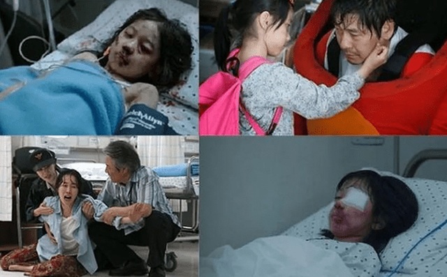 Hàn Quốc: Cô bé nguyên mẫu trong phim Hope 20 tuổi vẫn mặc tã còn thủ ...