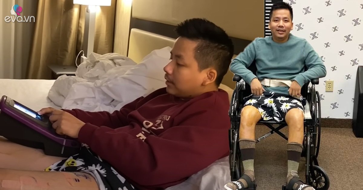 Chi hơn 5 tỷ kéo chân, Khoa Pug cao từ 1m67 lên 1m80 mà không cần đeo ...