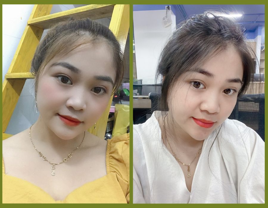 Dầu gội Ha'sol có giảm rụng tóc hiệu quả không?