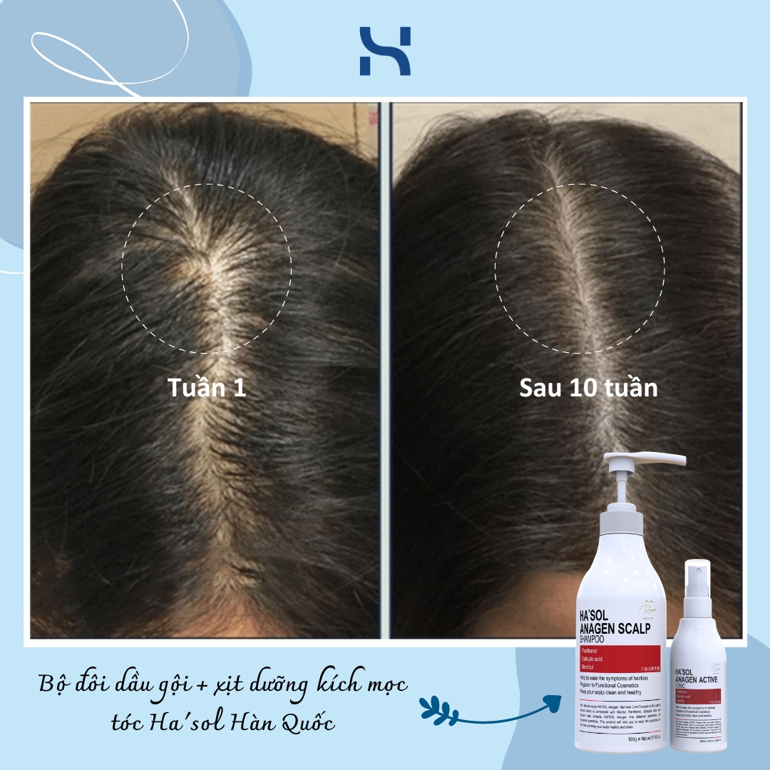 Dầu gội Ha'sol có giảm rụng tóc hiệu quả không?