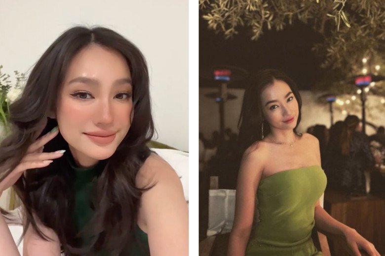 Từng bị nghi sửa đến sưng mặt, Á hậu sang Mỹ ở ẩn, ngày về Việt Nam không phấn son lộ dung mạo thật