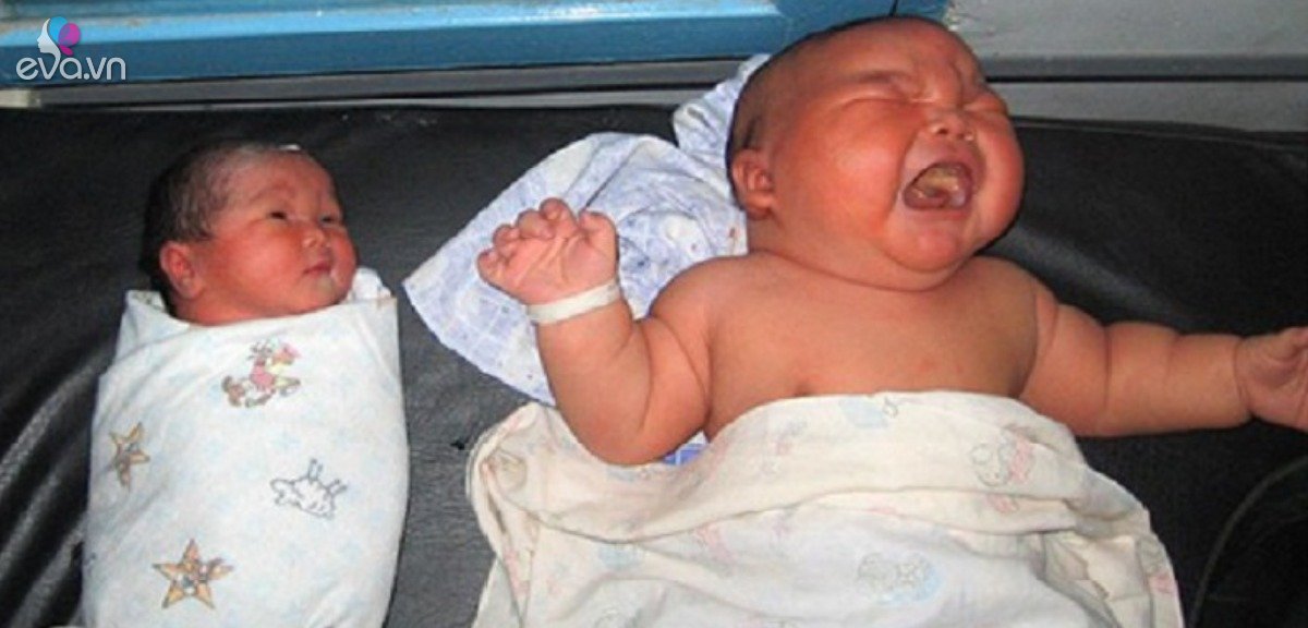 Những em bé vừa chào đời đã khiến mọi người sửng sốt bởi điều kỳ lạ