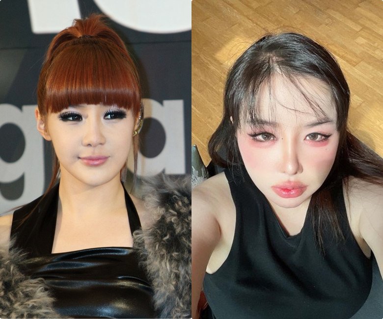 Không nhận ra Park Bom trong ảnh mới, da trắng như tuyết nhưng đôi mắt như người vô hồn