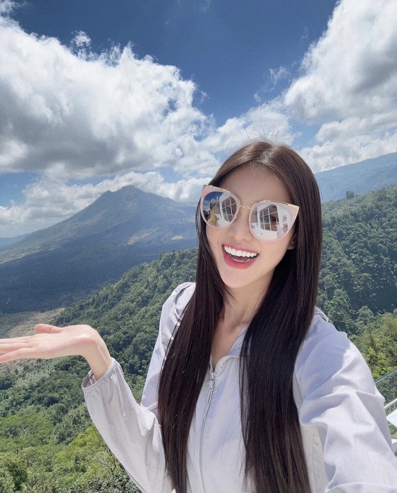 Búp bê sống Việt Nam từng không dám cười, nhờ dán lớp sứ giá gần chục ...