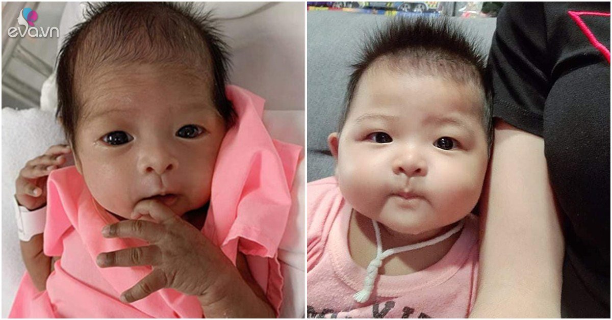 Con sinh thiếu tháng 1,39kg, da nhăn nheo, 6 tháng sau mẹ bật khóc vì may đã không vứt bỏ