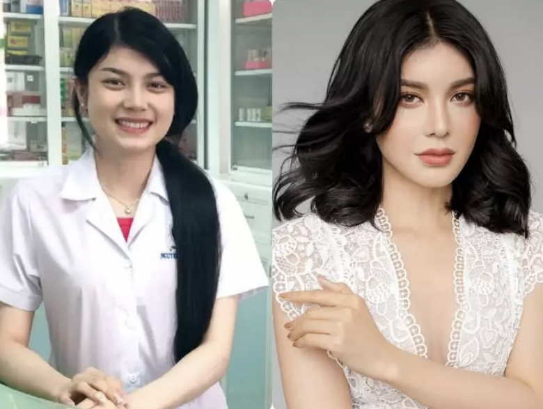 Tình địch một thời của Ngọc Trinh sửa mũi 3 lần, giờ chưa tới 30 nhưng ...