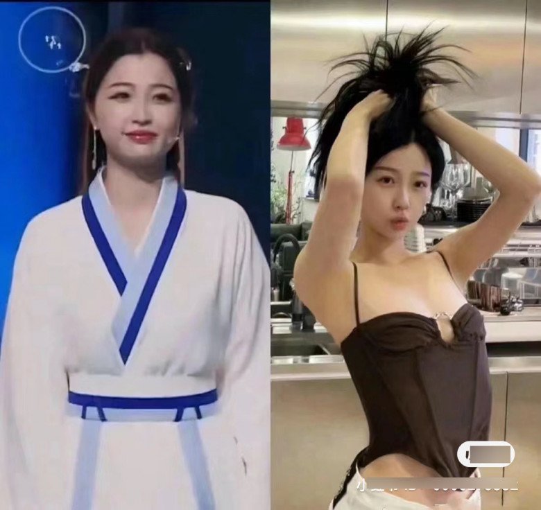 Rộ lên phương pháp phẫu thuật thẩm mỹ 0 đồng, chẳng đau đớn mà gọn mặt thần kỳ